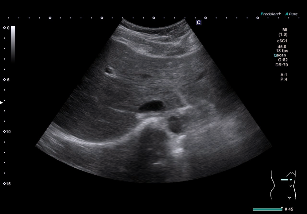 normal_liver_ultrasound | 東京千住・胃と大腸の消化器内視鏡クリニック 足立区院